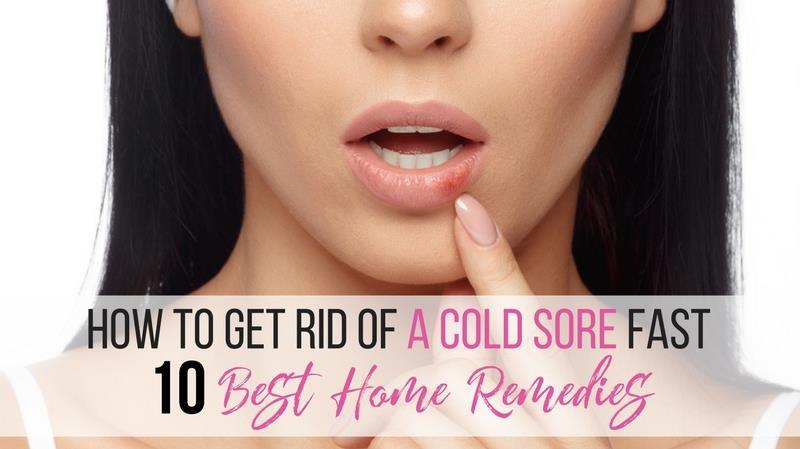 How to Get Rid of Cold Sores Fast: 10 Best Home Remedies