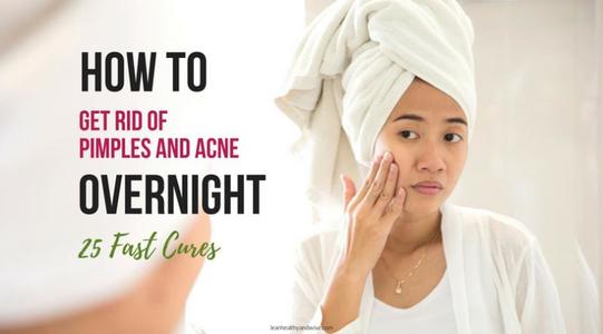 How to Get Rid of Pimples and Acne Overnight: 25 Fast Cures