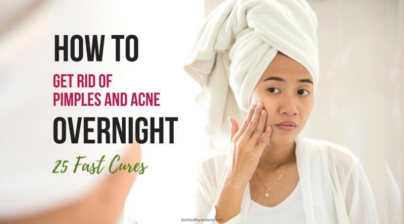 How to Get Rid of Pimples and Acne Overnight: 25 Fast Cures